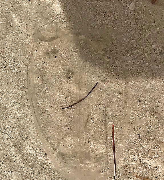 2 taken to hospital for jellyfish stings - Cayman Compass