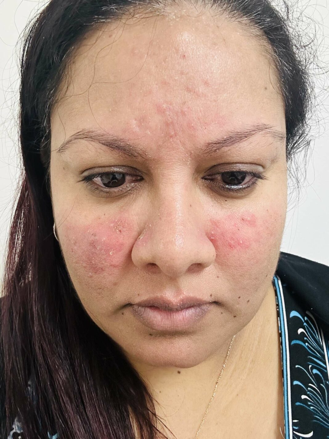 May brings lupus into focus - Cayman Compass